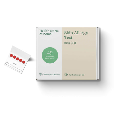 Skin Allergy Test Kit: IgE Analysis for Clear Insights – Check My Body ...