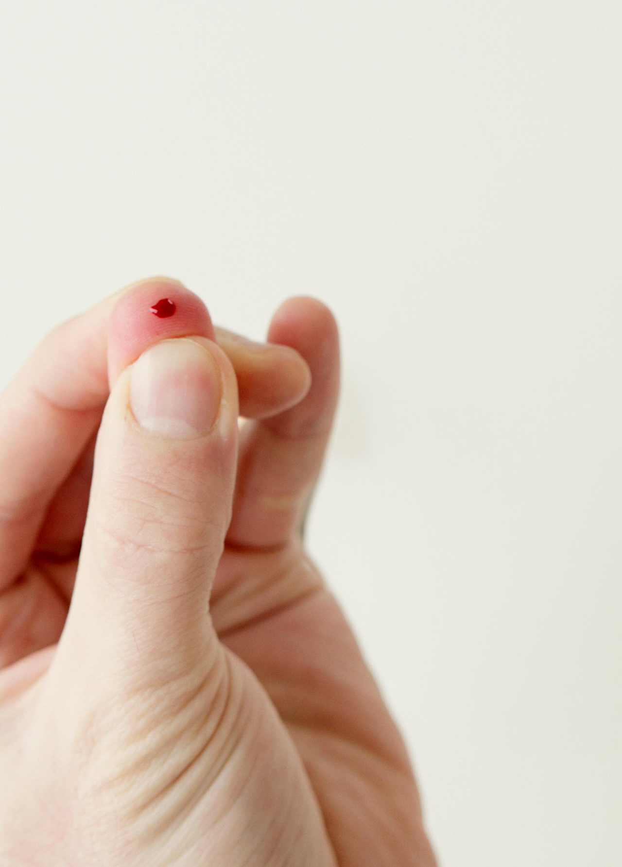 Allergy testing – Check My Body Health USA